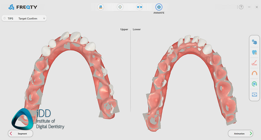 Panda SMART Intraoral Scanner Review by iDD