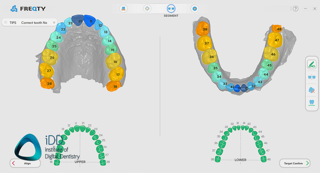 Panda SMART Intraoral Scanner Review by iDD