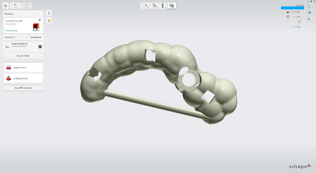 Dental Implant Treatment from Start to Finish using 3Shape TRIOS