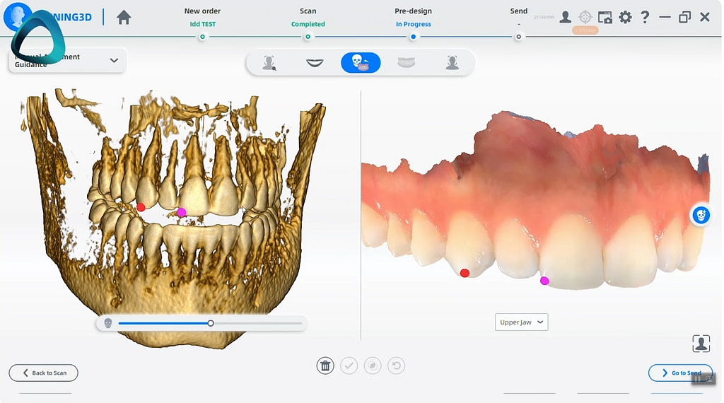 MetiSmile 3D Dental Face Scanner Review! Is it worth the cost?