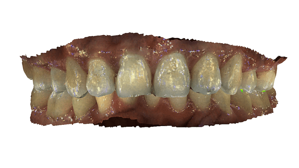 WOW Intraoral Scanner Review | Digital Dentistry Blog | Online Courses