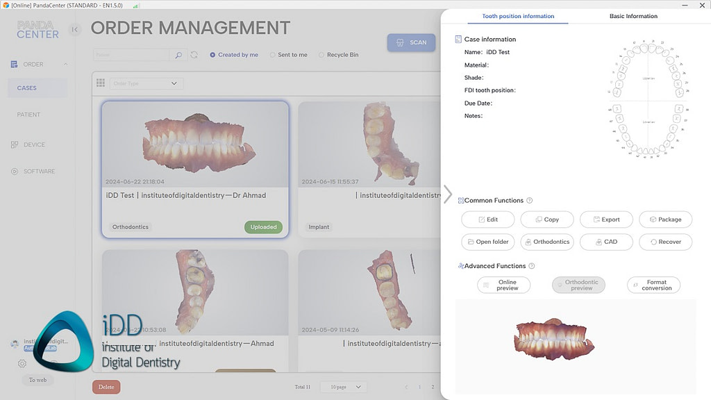 Panda SMART Intraoral Scanner Review by iDD