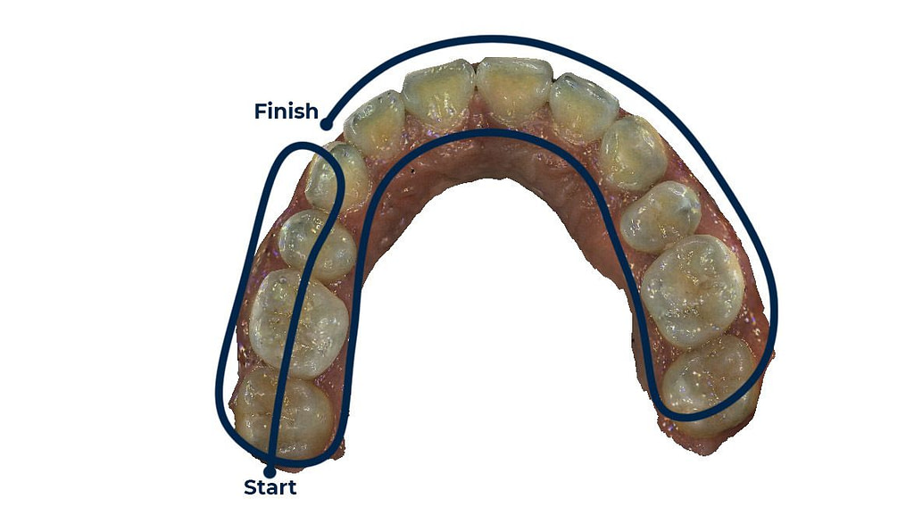 WOW Intraoral Scanner Review | Digital Dentistry Blog | Online Courses