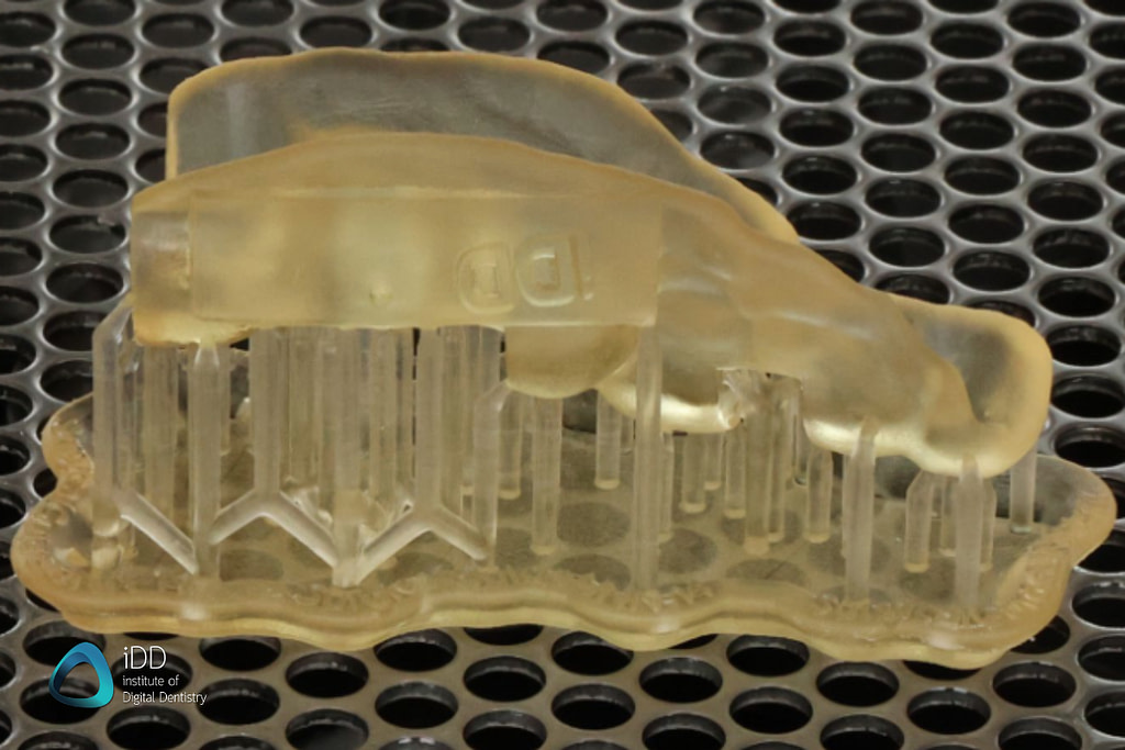 How to 3D Print Implant Surgical Guides for Stress-Free Implant ...