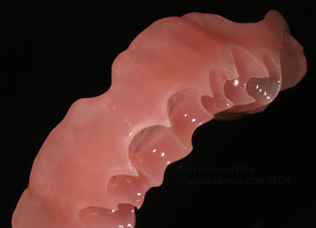 Graphy Tera Herz Flexible Base - Printed Partial Denture Review