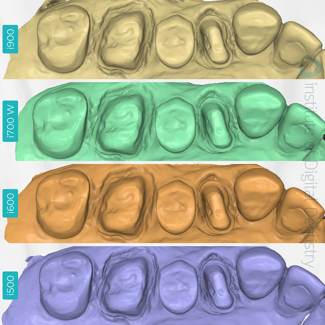 iDD Compares Medit i500 vs. i600 vs. i700 Wireless vs. i900