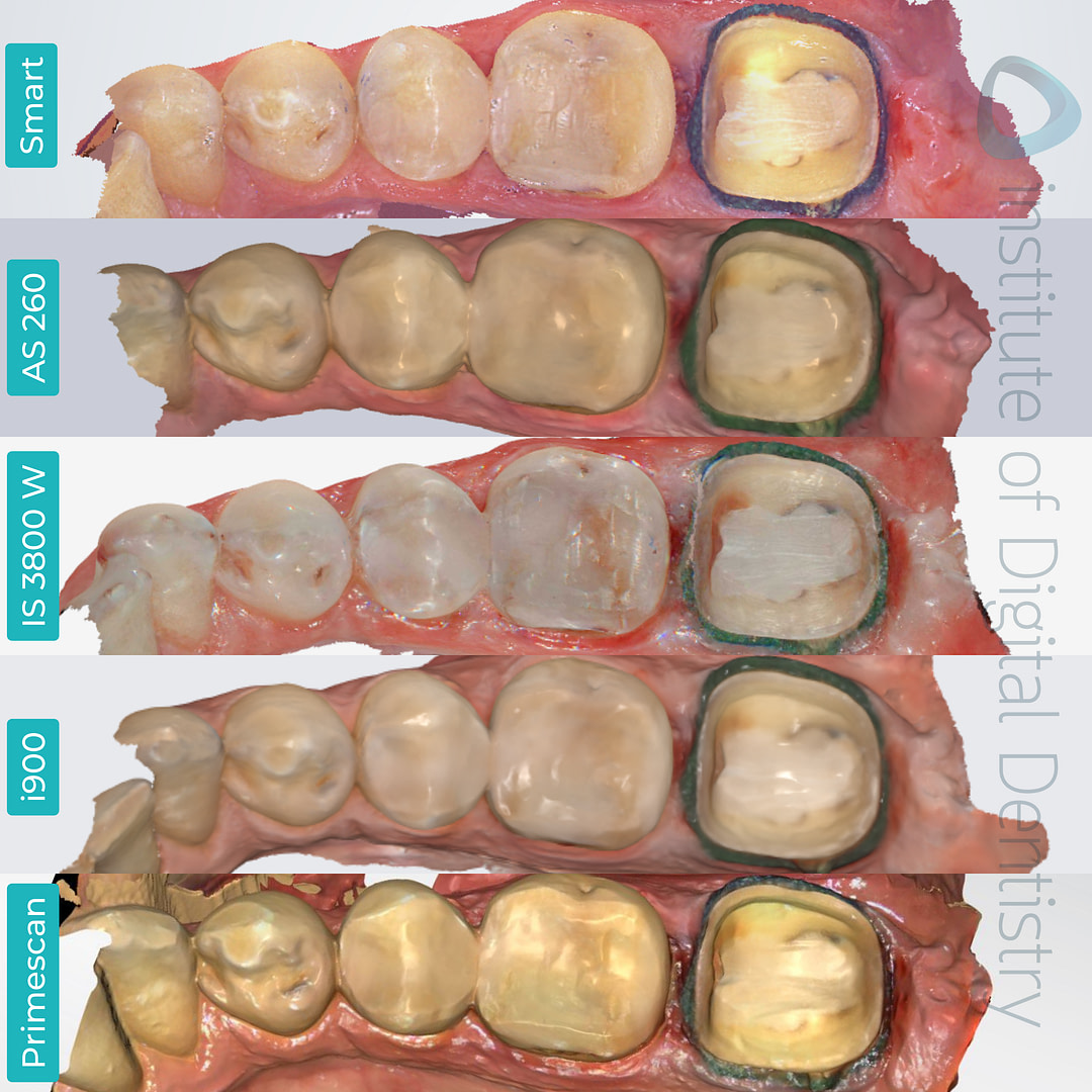 DEXIS IS 3800 Wireless Intraoral Scanner Review by iDD