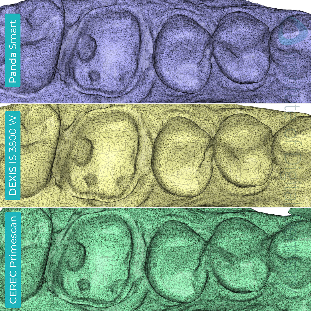 Panda Smart vs. DEXIS IS 3800 W vs. CEREC Primescan
