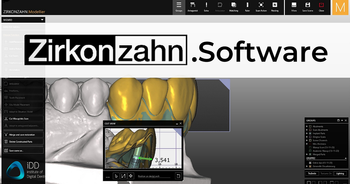 The Ultimate Guide to Dental CAD Software in 2024 - Institute of ...