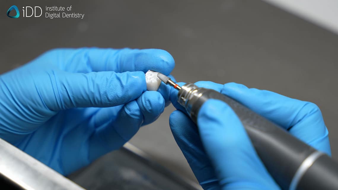 How to 3D Print Dental Crowns with iDD - Institute of Digital Dentistry