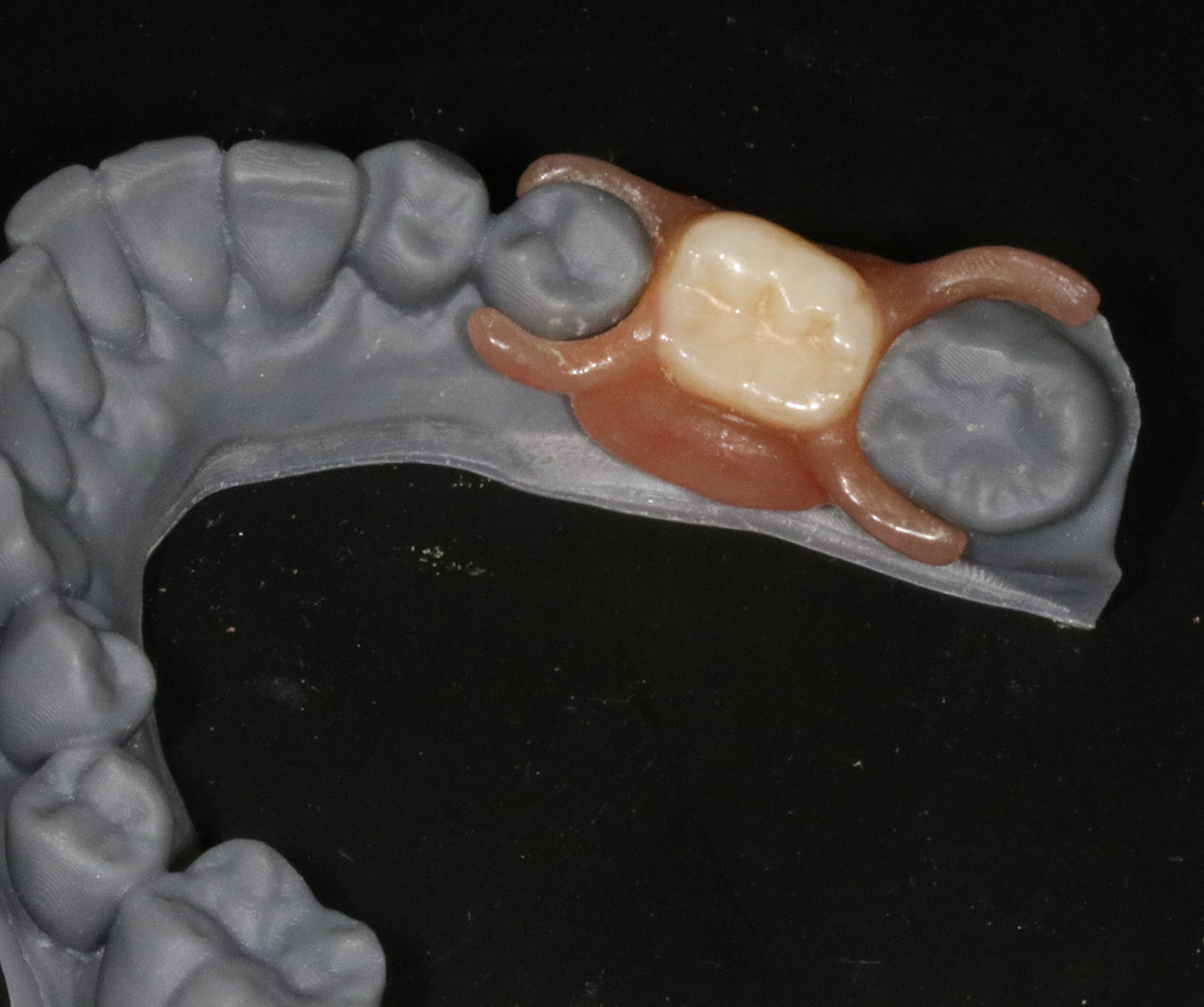 Graphy Tera Herz Flexible Base - Printed Partial Denture Review
