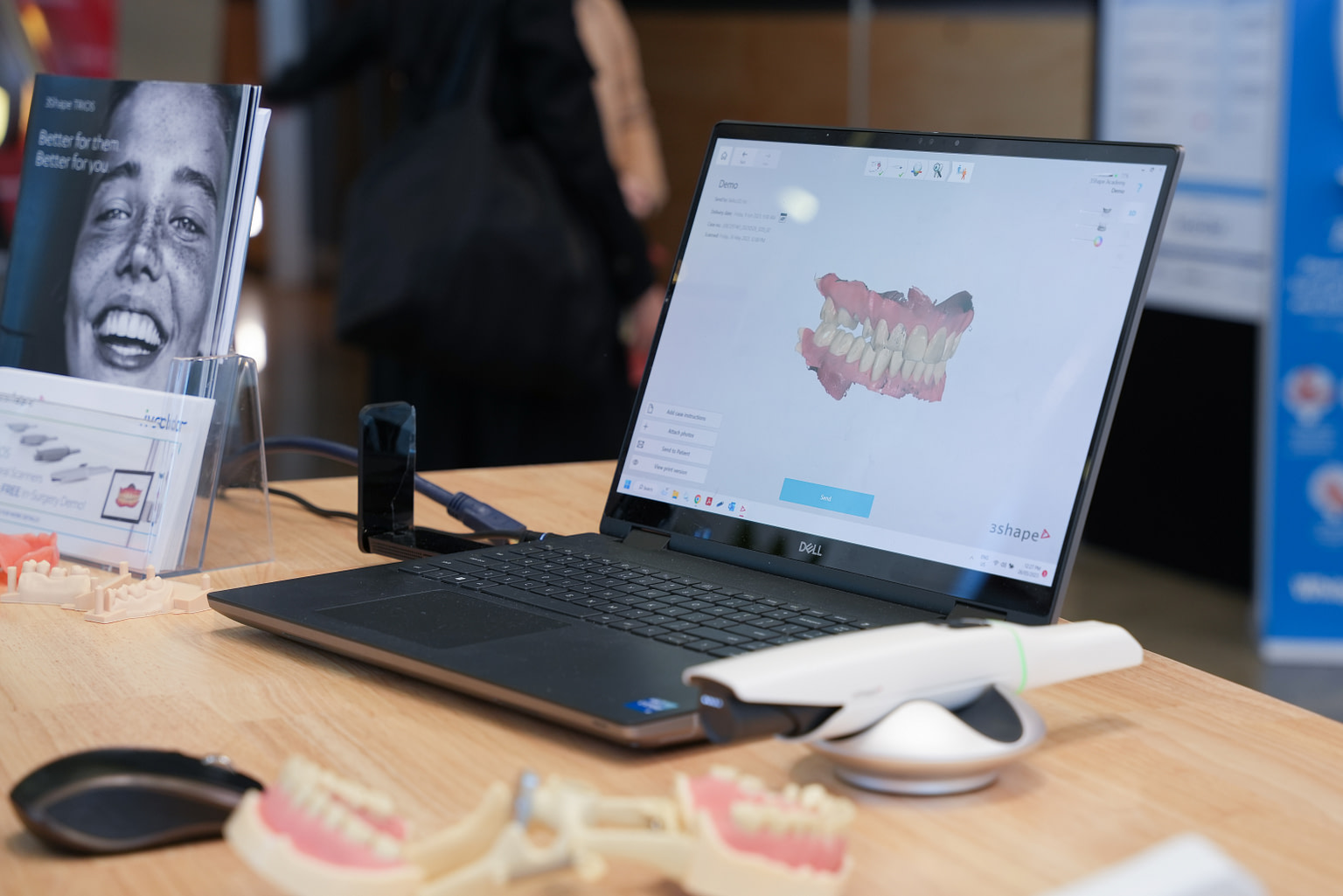 3Shape TRIOS 5 Intraoral Scanner Review