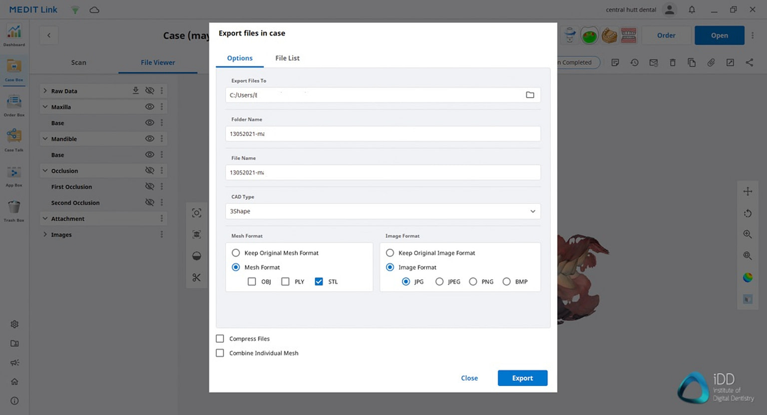 Medit i700 Wireless Intraoral Scanner Review + Medit Apps