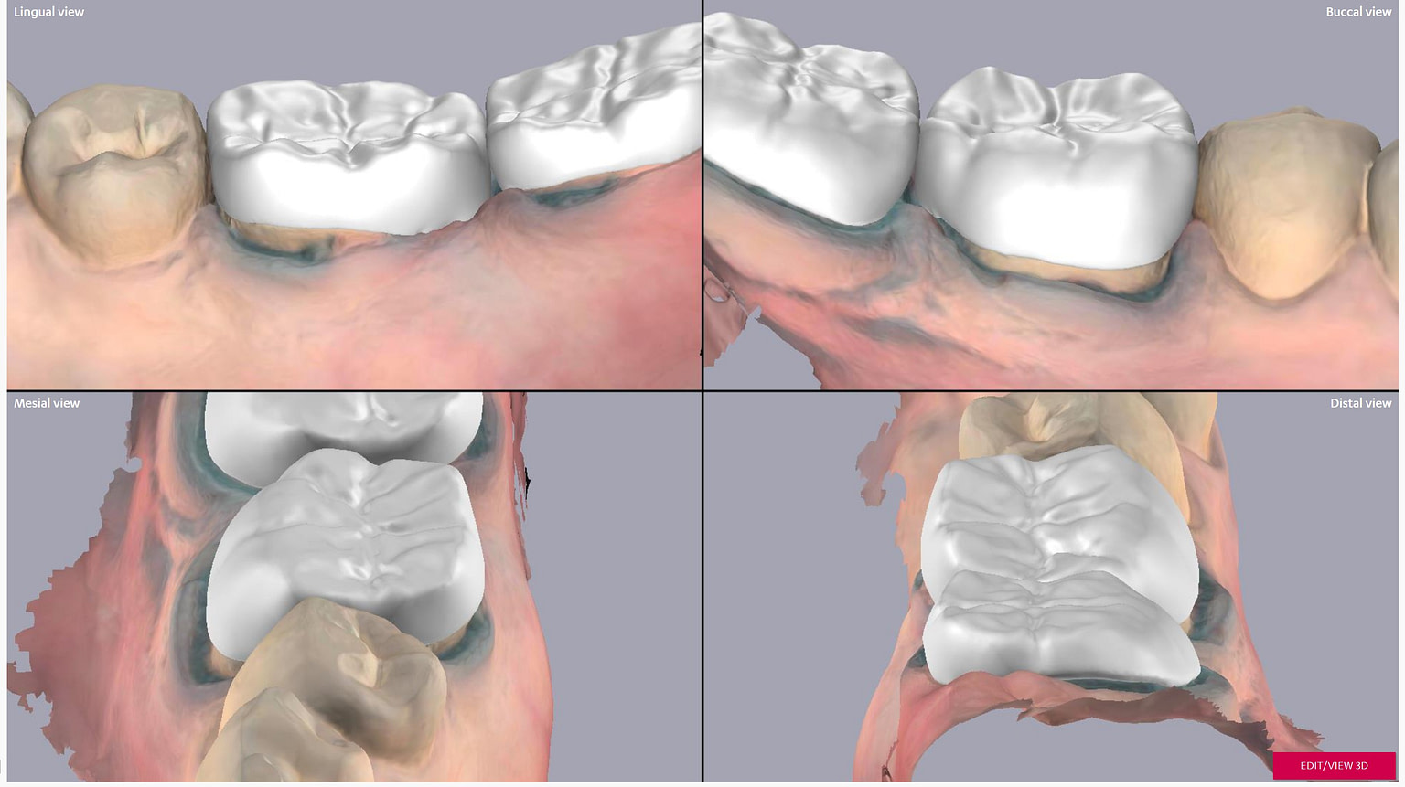 3Shape TRIOS 5 Intraoral Scanner Review