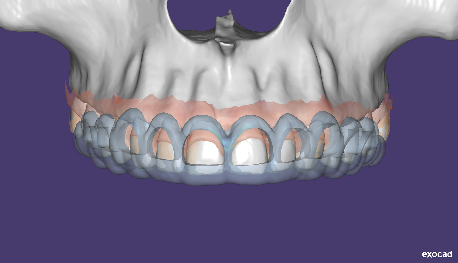Diagnocat Review - AI Diagnostics of 2D and 3D X-rays in Dentistry