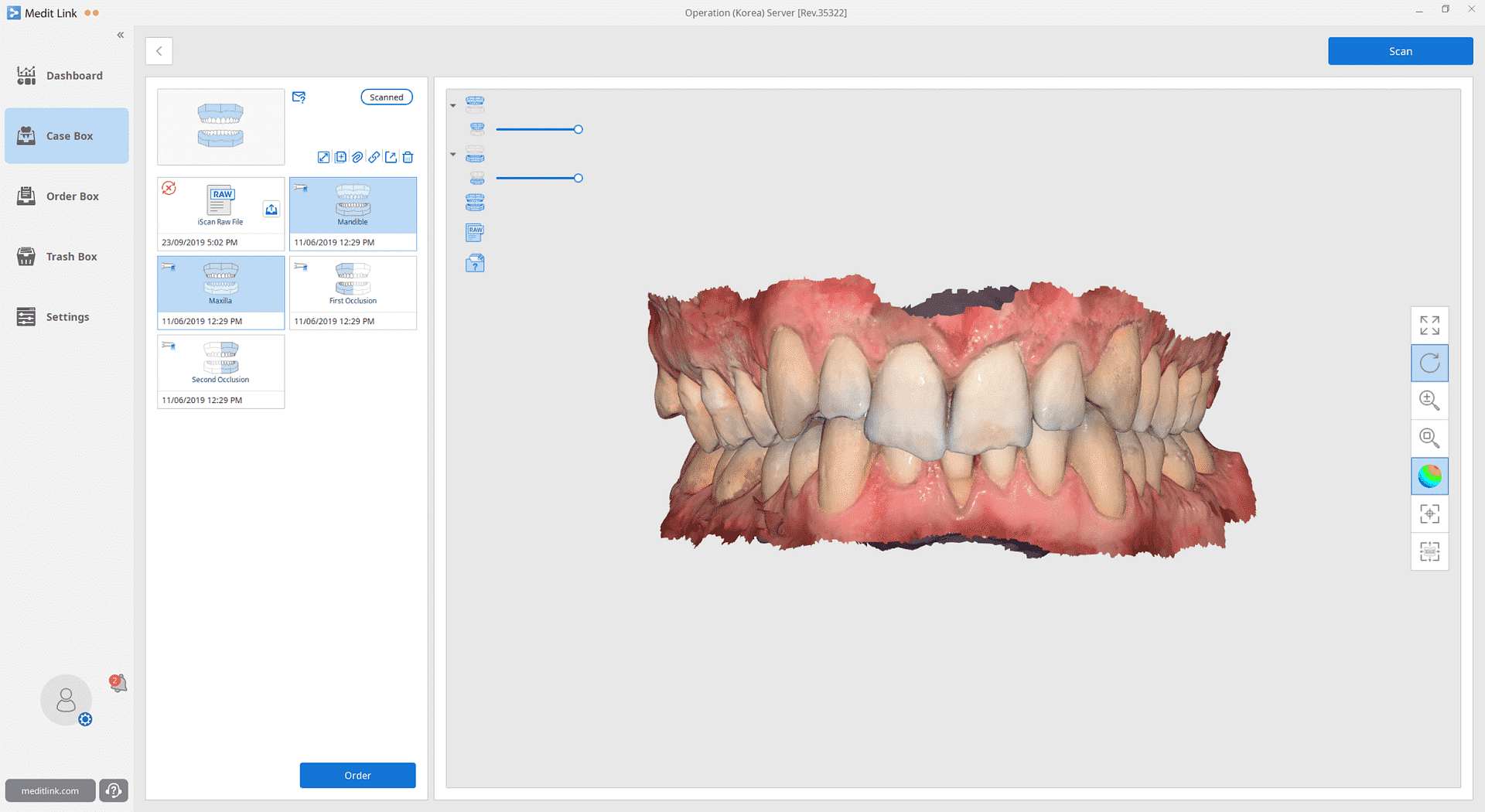 Medit i500 Review | Digital Dentistry Blog | Online Training & Courses
