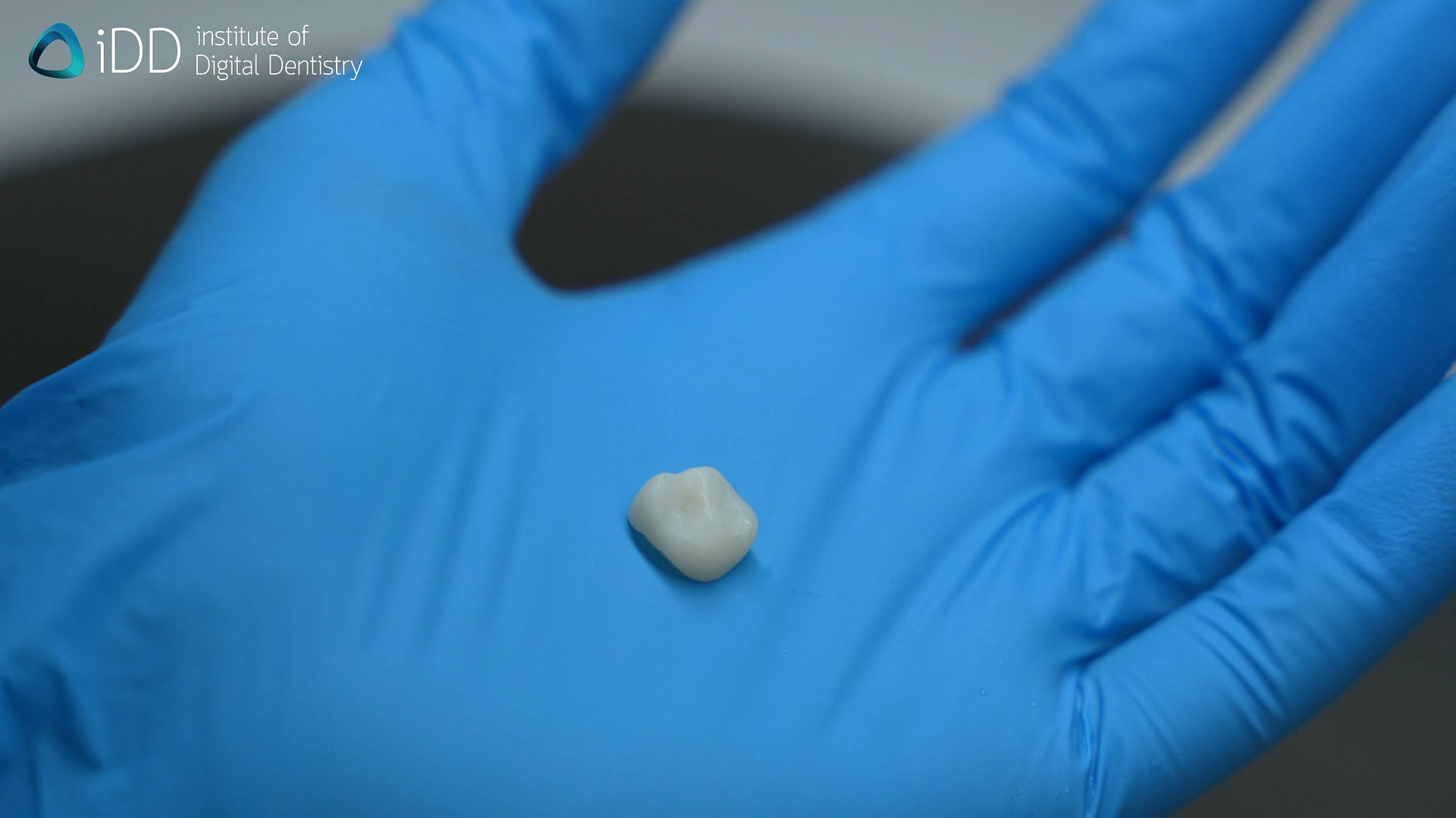 How to 3D Print Dental Crowns with iDD - Institute of Digital Dentistry