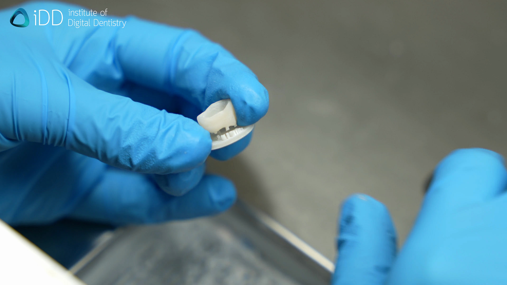 How to 3D Print Dental Crowns with iDD - Institute of Digital Dentistry