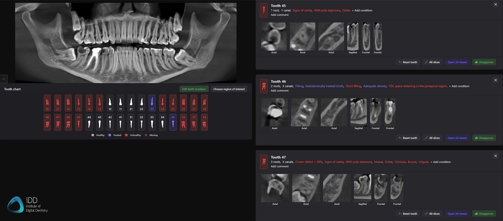 CBCT File Formats: Understanding Their Role in Dentistry - Institute of Digital Dentistry