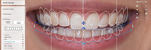 Digital Smile Design Online Course CE Institute Of Digital Dentistry