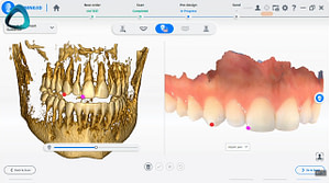 MetiSmile 3D Dental Face Scanner Review! Is it worth the cost?