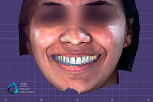 RAYFace Review – Is it the Best 3D Facial Scanner for Dentists?