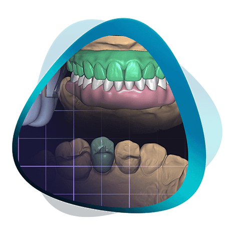 Dental CAD Design Software | Institute Of Digital Dentistry