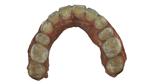 WOW Intraoral Scanner Review | Digital Dentistry Blog | Online Courses