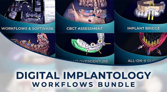 Digital Implantology Online Course Bundle - Learn Digital Dentistry