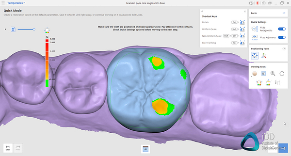 Medit i700 Wireless Intraoral Scanner Review + Medit Apps