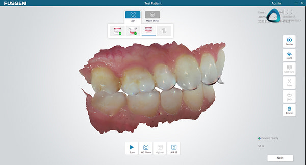 Fussen DentaLink Scanner Review | Institute of Digital Dentistry