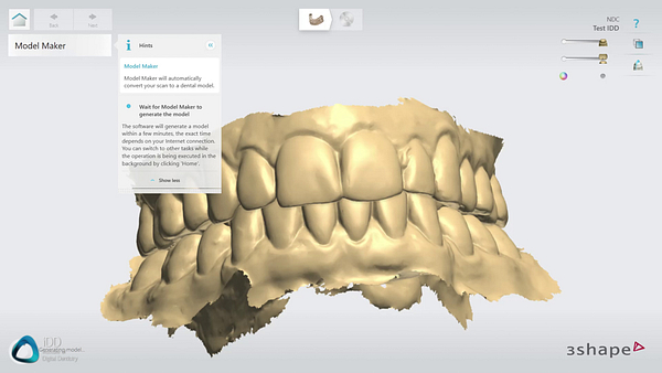 3Shape Unite Review | Institute of Digital Dentistry