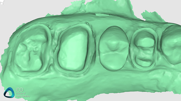 Helios 600 Intraoral Scanner Review | Institute of Digital Dentistry