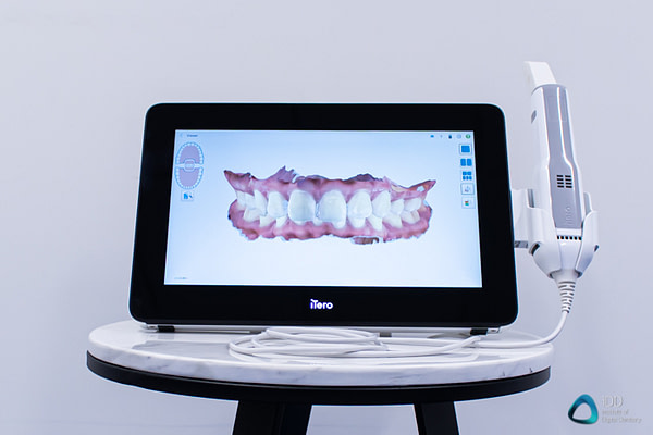 iTero Element 5D Plus Review | Digital Dentistry Blog | Online Courses