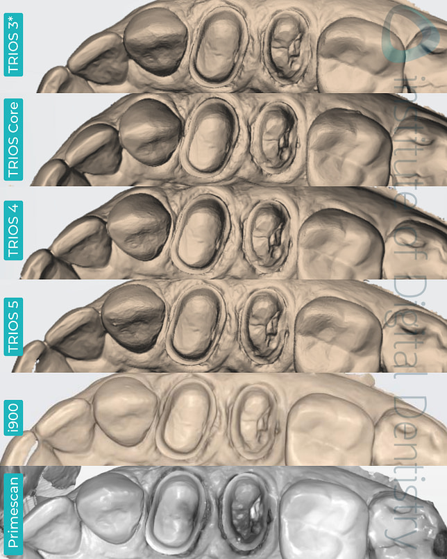 TRIOS Intraoral Scanners vs. Medit i900 vs. CEREC Primescan