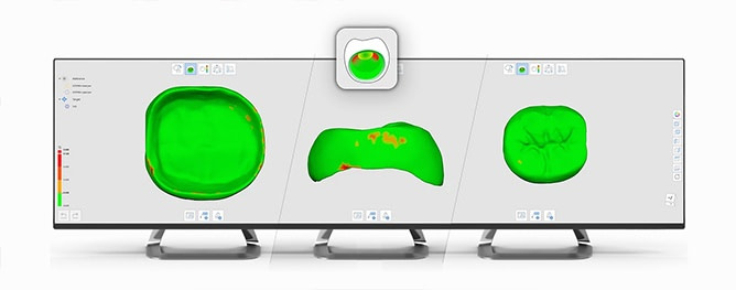 New Medit Apps | Digital Dentistry Blog | Online Courses & Training