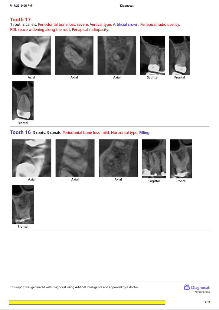 Diagnocat Review - AI Diagnostics of 2D and 3D X-rays in Dentistry