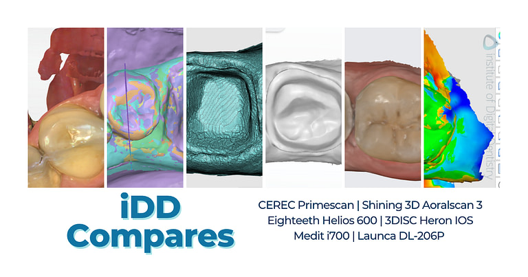 Do Affordable IO Scanners Perform As Well as Expensive Ones?