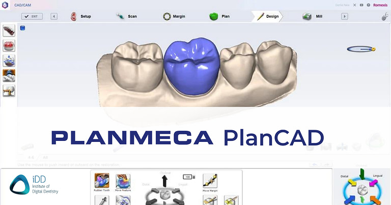 The Ultimate Guide to Dental CAD Software in 2024 - Institute of ...