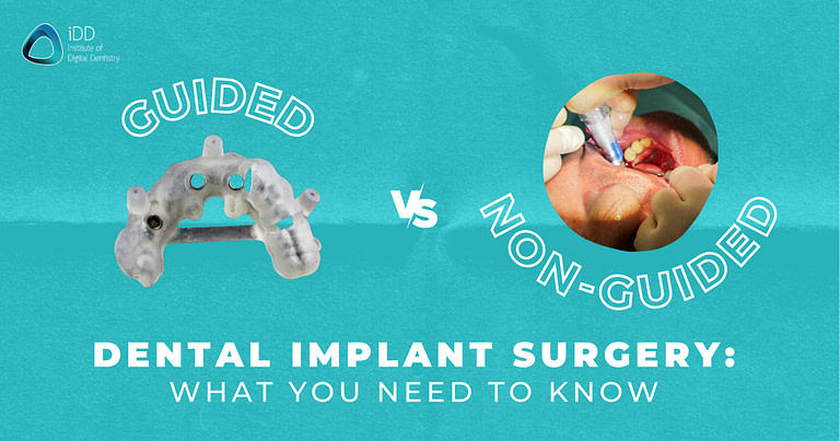 Guided vs. Non-Guided Dental Implant Surgery