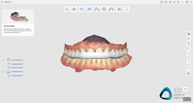 Medit i700 Wireless Intraoral Scanner Review + Medit Apps