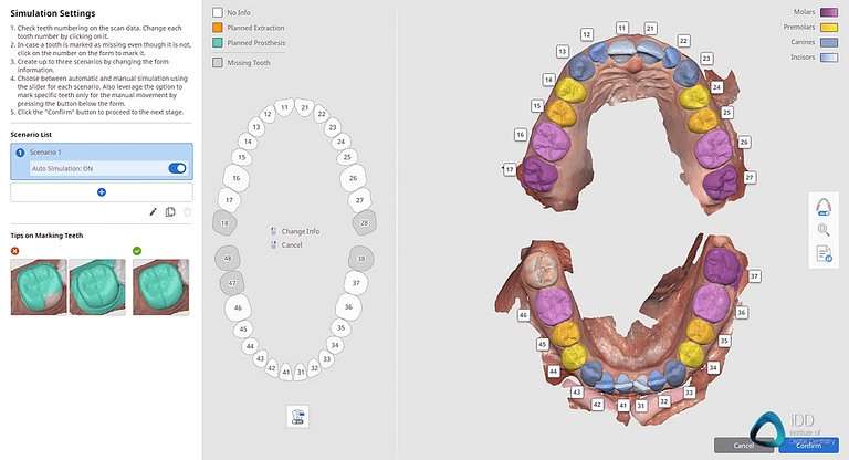 Medit i700 Wireless Intraoral Scanner Review + Medit Apps