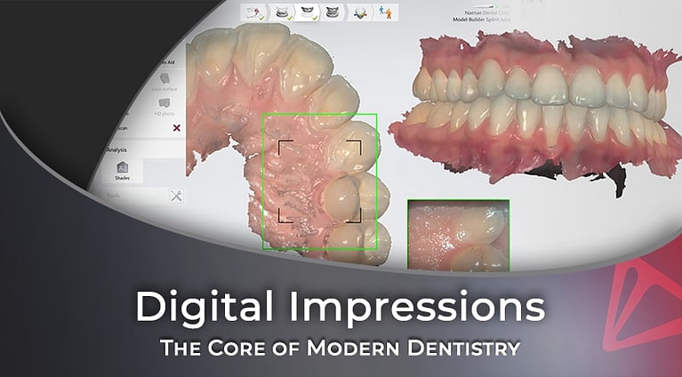 Intraoral Scanning & Digital Impressions | Institute Of Digital Dentistry
