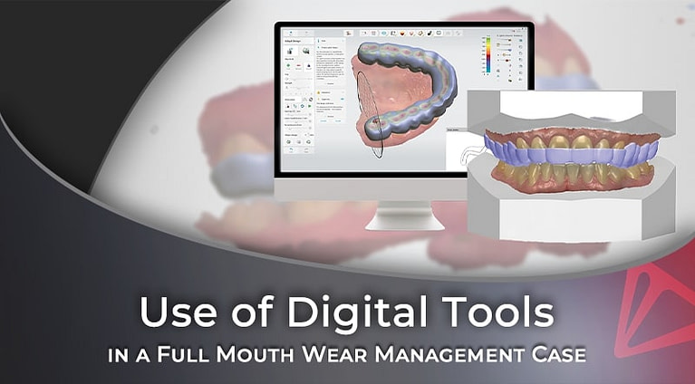 Learn Digital Smile Design | Institute Of Digital Dentistry