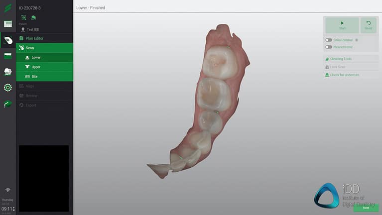 Straumann Virtuo Vivo Intraoral Scanner Review