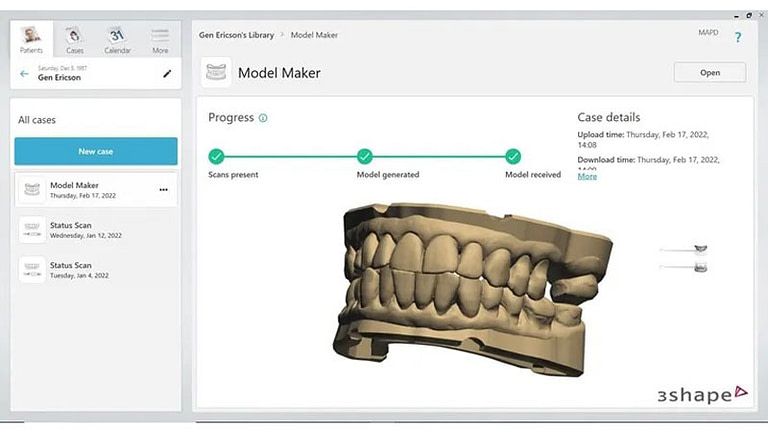 3Shape TRIOS 5 Intraoral Scanner Review