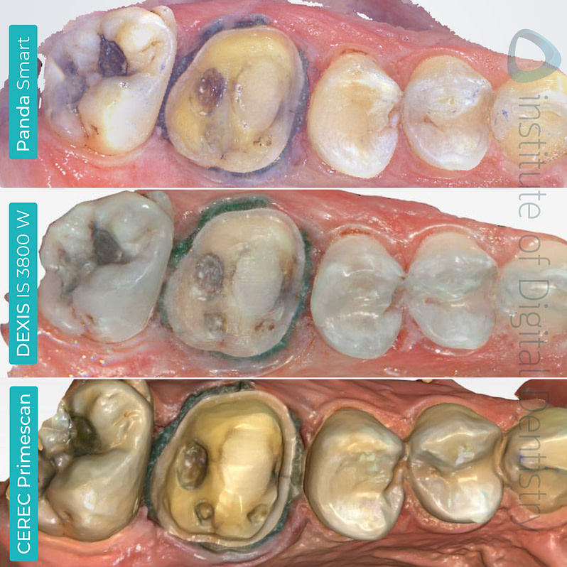 Panda Smart vs. DEXIS IS 3800 W vs. CEREC Primescan