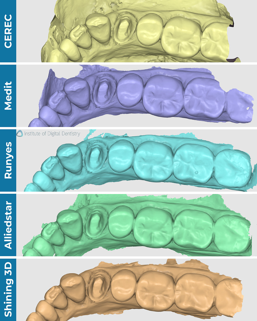 iDD Compares: A Comprehensive Comparison of Affordable vs. High-End ...