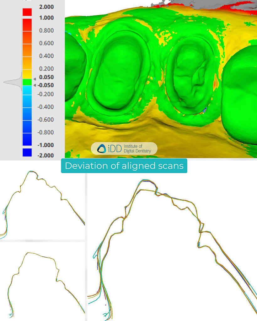 TRIOS Intraoral Scanners vs. Medit i900 vs. CEREC Primescan