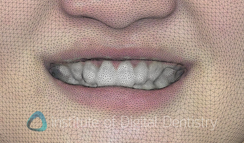 Face Scanners in Dentistry - Handheld, Desktop or iPhone App?